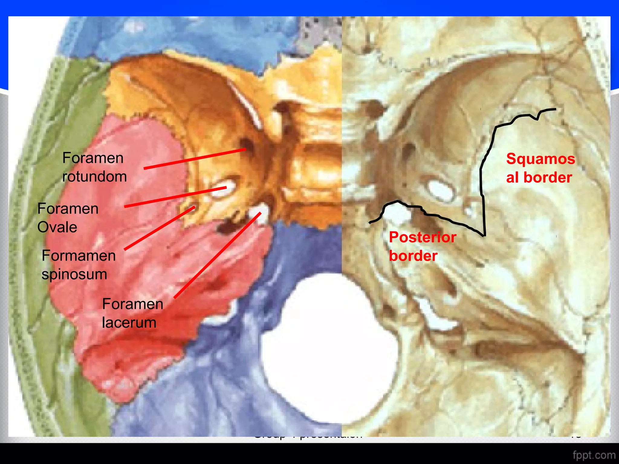 Sphenoid bone (osteology) | PPT