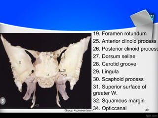 Sphenoid bone (osteology) | PPT