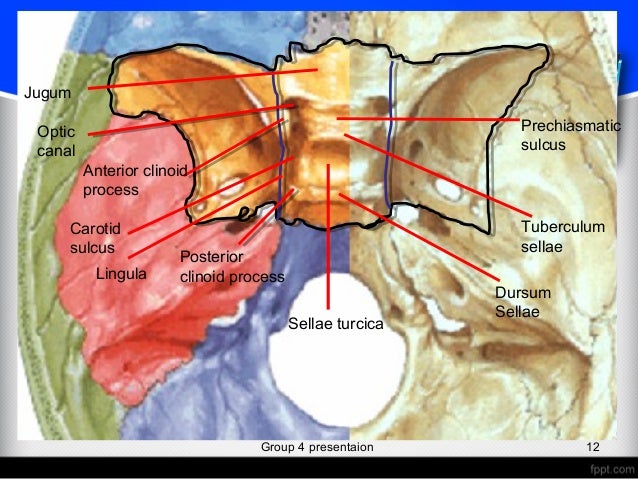 Sphenoid bone (osteology)