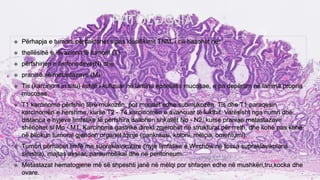 KARCINOMA E LUKTHIT-punim seminarik (per fakultetin mjekesise) | PPTX