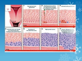 Karcinom grlica i tijela materice | PPTX