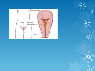 Karcinom grlica i tijela materice | PPTX