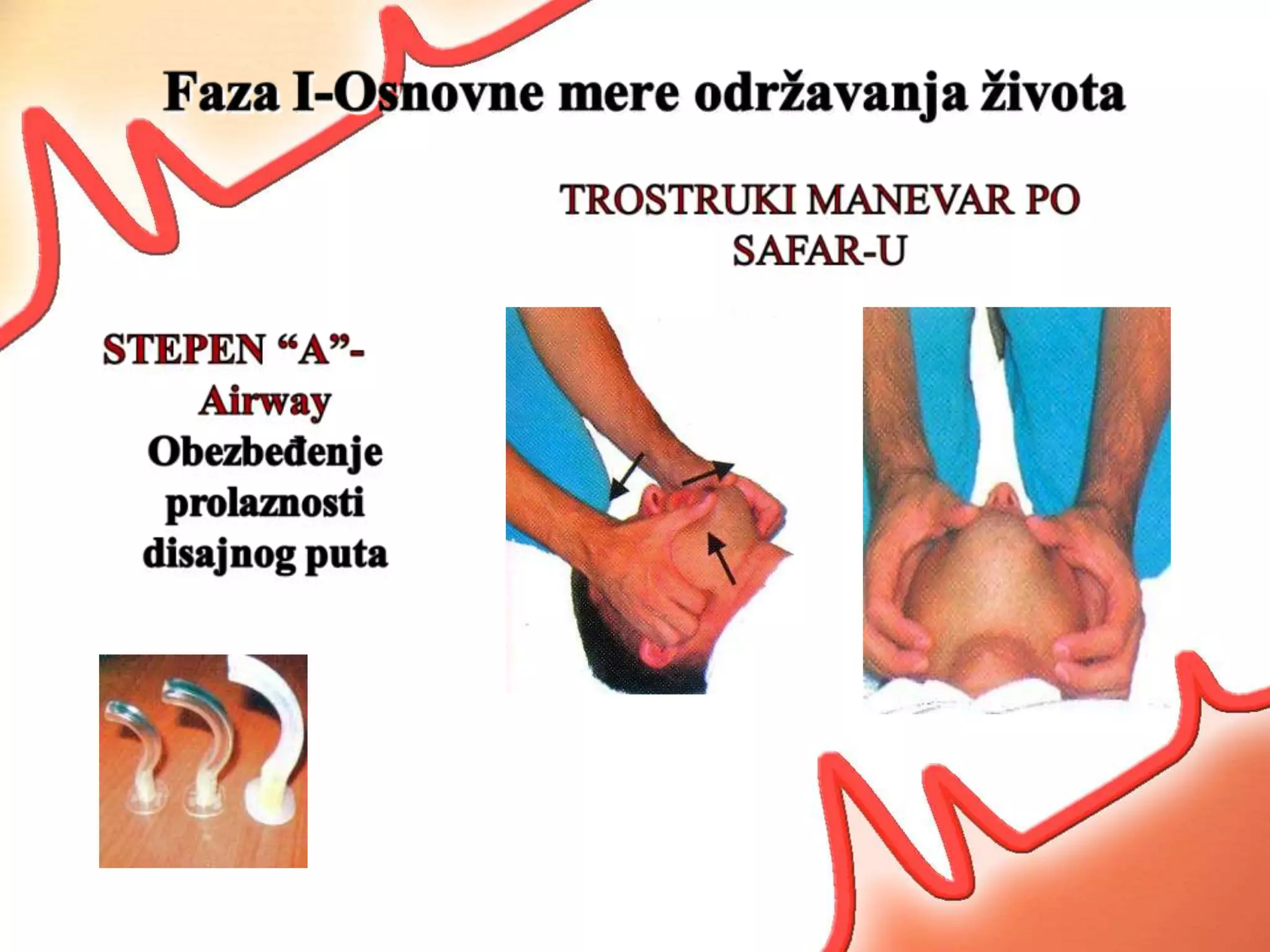 Kardiopulmonalna reanimacija | PPT