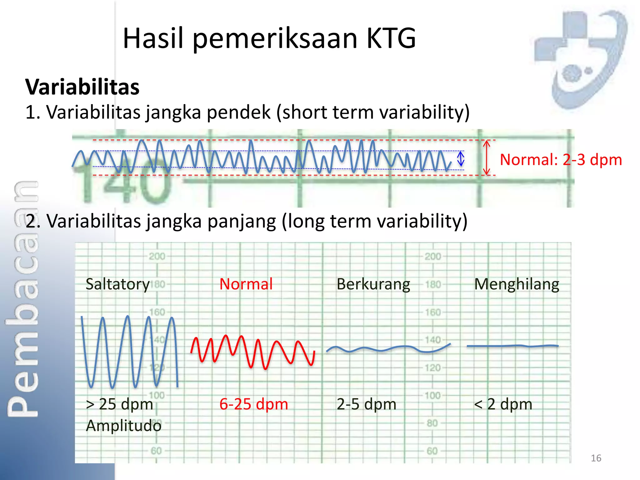 Kardiotokografi | PPTX