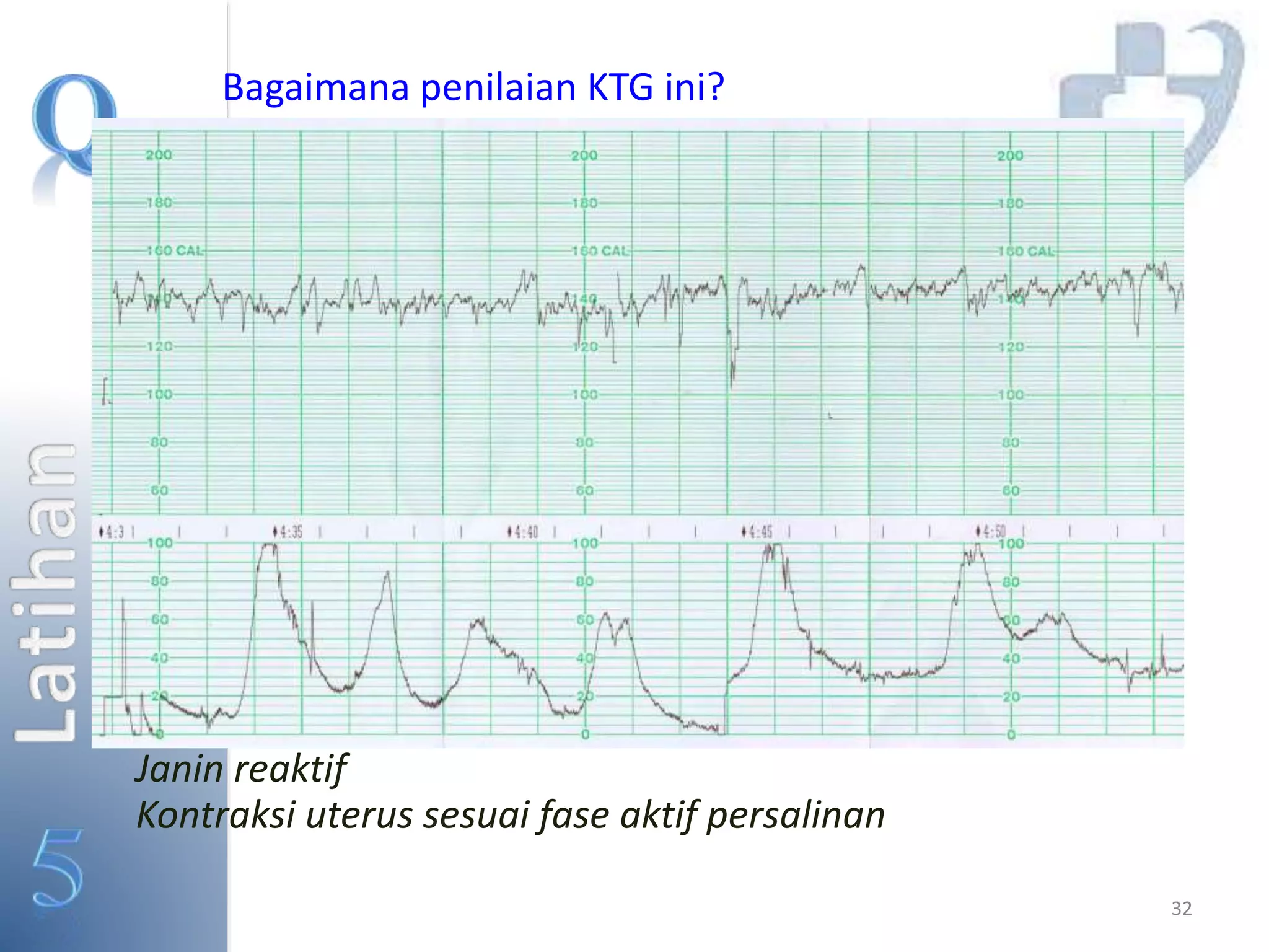 Kardiotokografi | PPTX