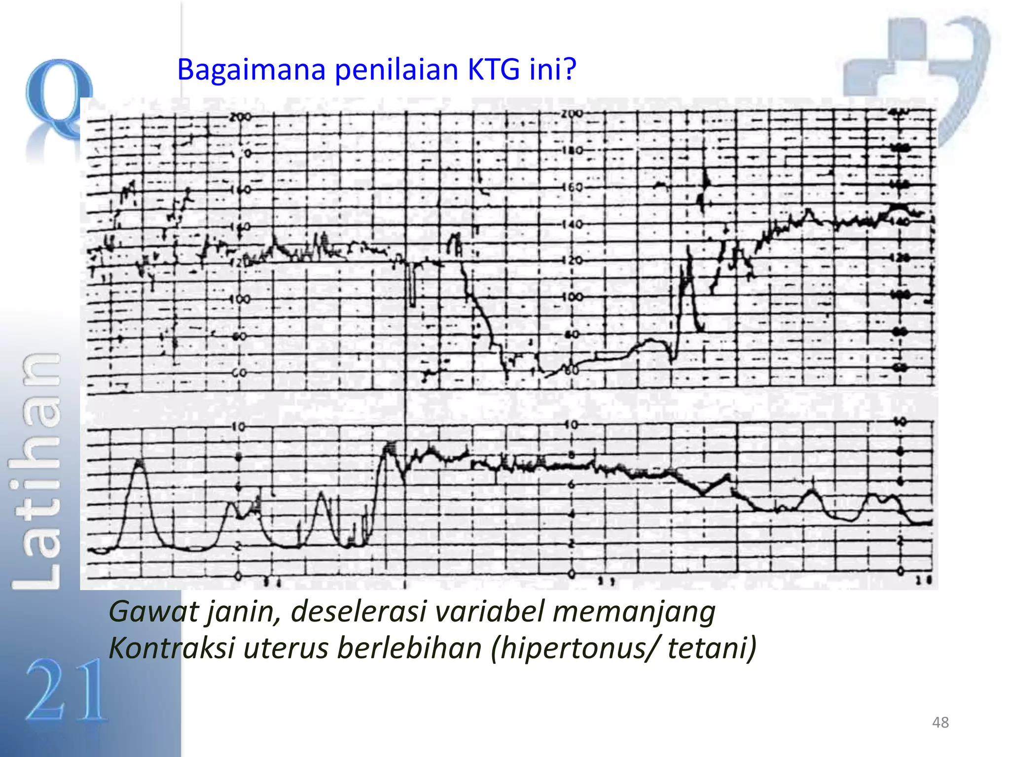 Kardiotokografi | PPTX