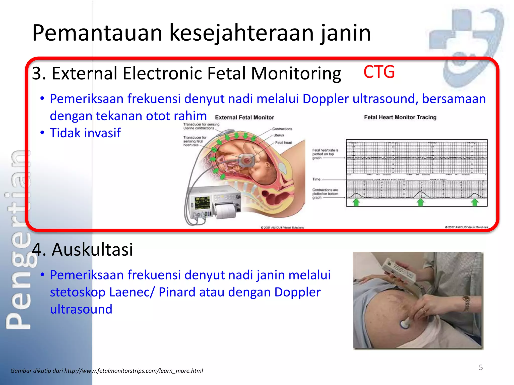 Kardiotokografi | PPTX