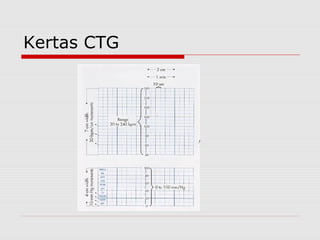 Kardiotokografi | PPT