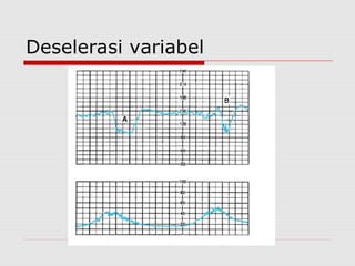 Kardiotokografi | PPT