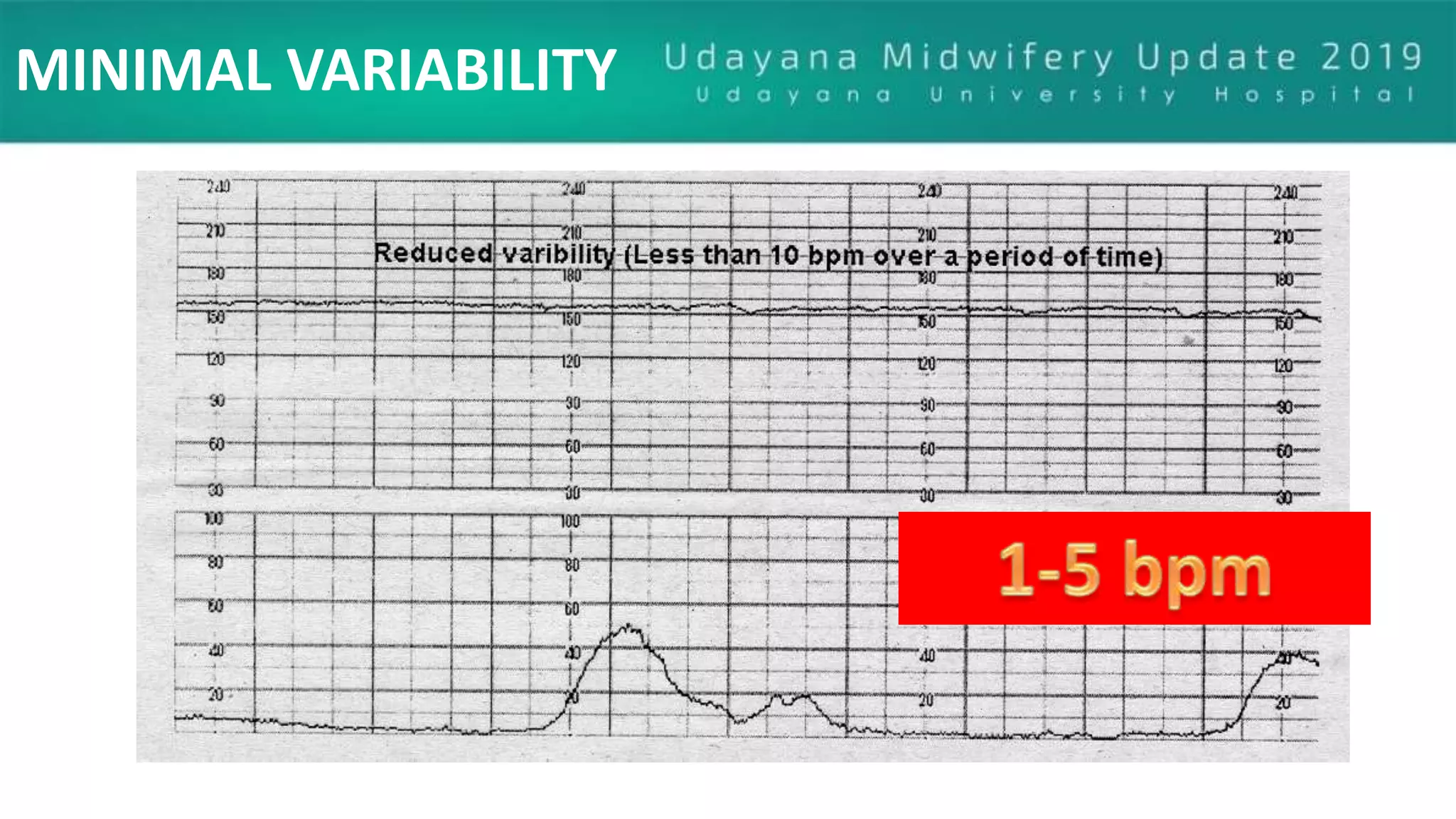 Kardiotokografi UMU 2019 | PPTX