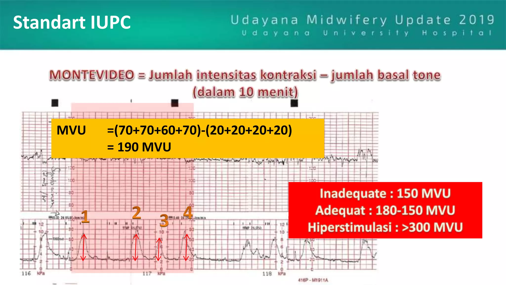 Kardiotokografi UMU 2019 | PPTX