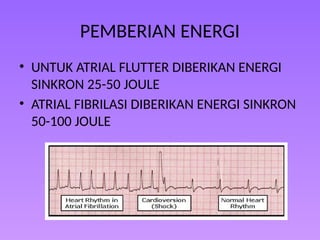 KARDIOVERSI.defibrilasi.kardioversi.defibrilasi | PPTX