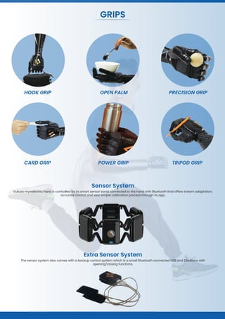 KARE Prosthetics and Orthotics - Metting Aspirations | PDF