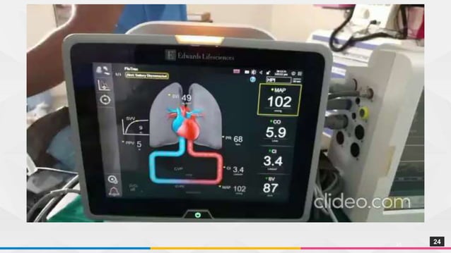 CARDIAC CASE FOR NON CARDIAC SURGERY | PPT
