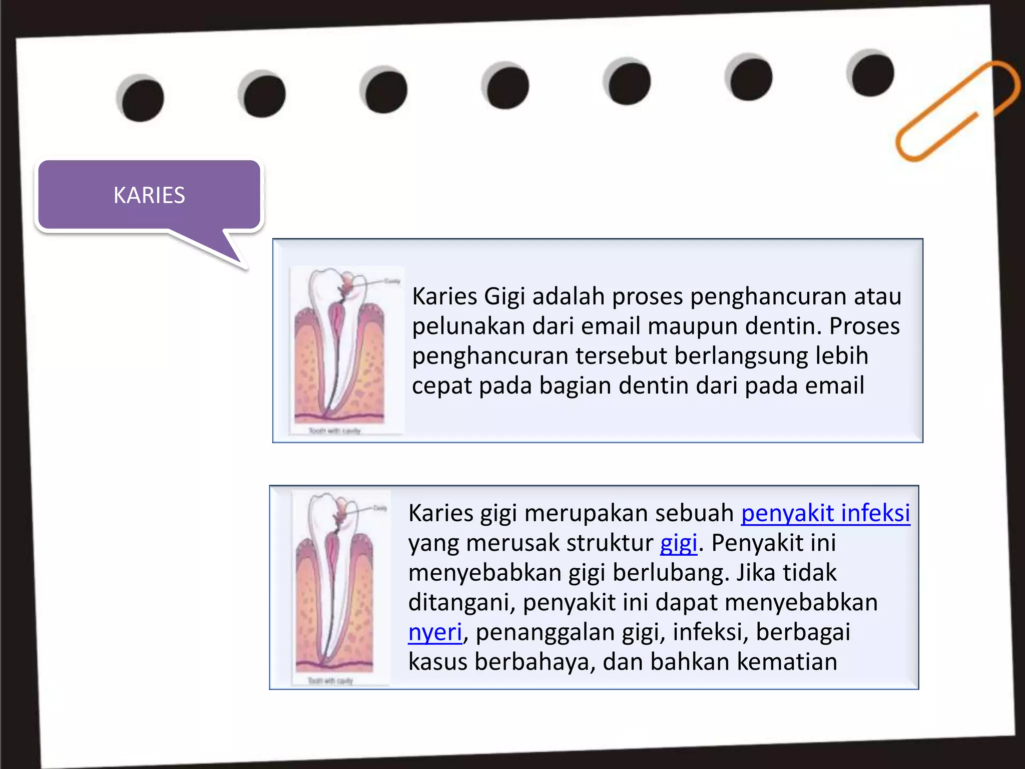 Karies gigi presentation | PPTX