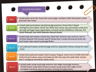 Karies gigi presentation | PPTX