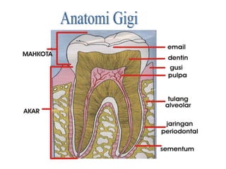 Karies dan gingivitis | PPT
