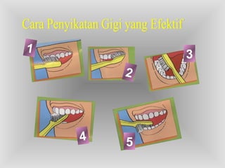 Karies dan gingivitis | PPT