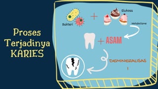 Karies Gigi by Drg. Andi Dini.pptx