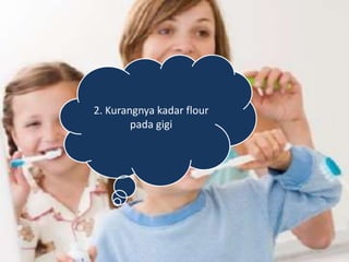 Karies (lubang gigi) | PPT