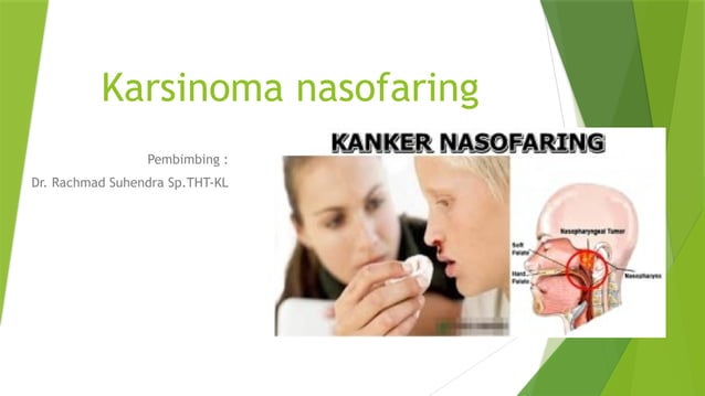 Karsinoma_nasofaring.pptx dr rachmad suhendra sp tht kl | PPTX