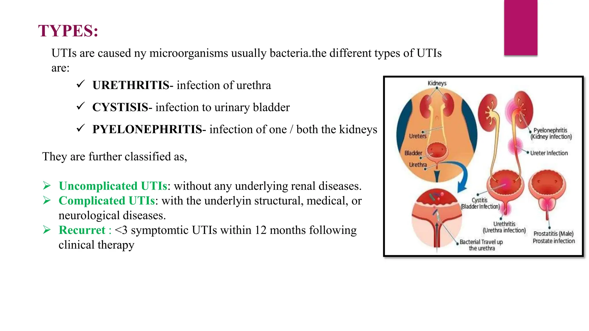 Case presentation On Urinary tract infection | PPTX