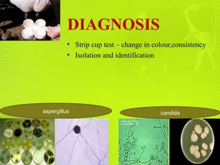 Mycotic mastitis | PPT