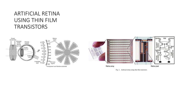 artificial retina | PPT
