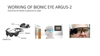 artificial retina | PPT