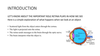 artificial retina | PPTX