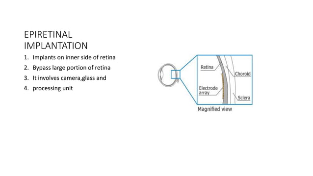 artificial retina | PPT