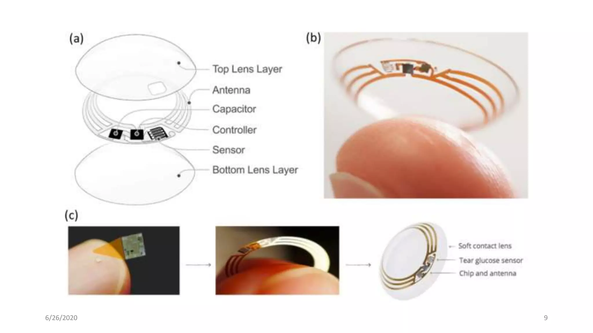 implantable iop sensor | PPTX
