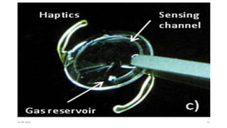 implantable iop sensor | PPT