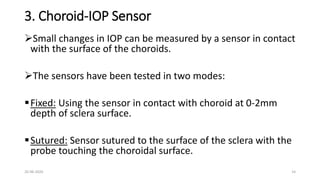 implantable iop sensor | PPT