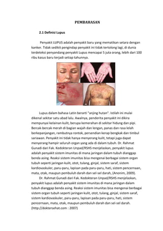 Karya tulis penyakit lupus | DOCX