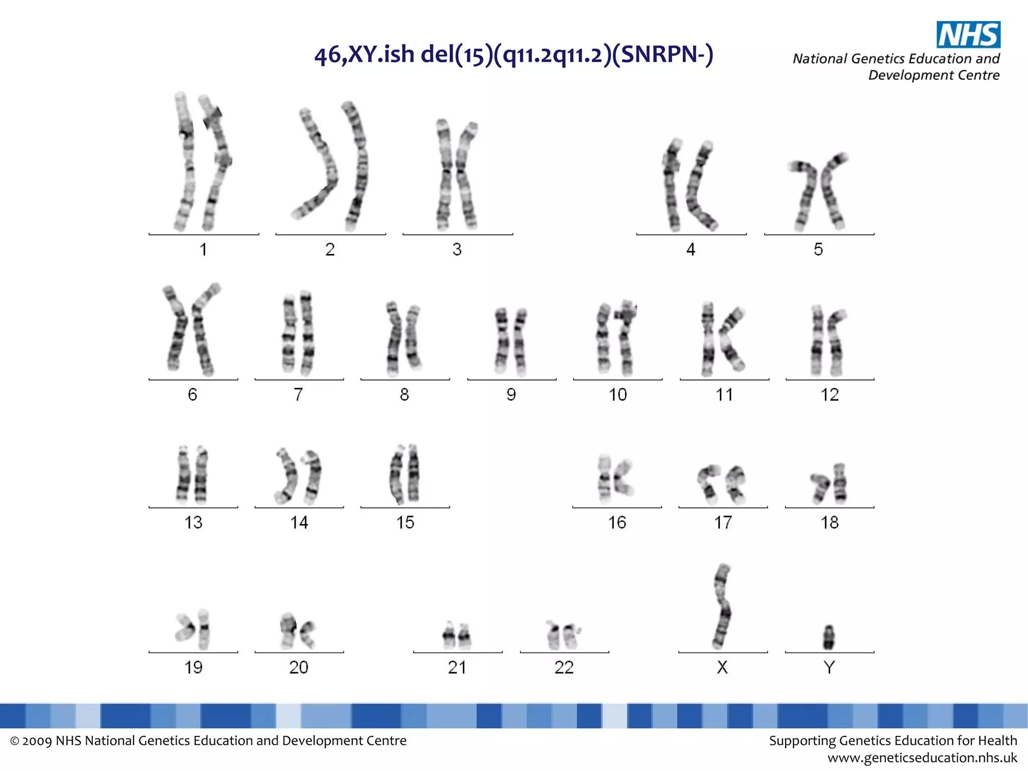 Karyotypes - Various | PPT