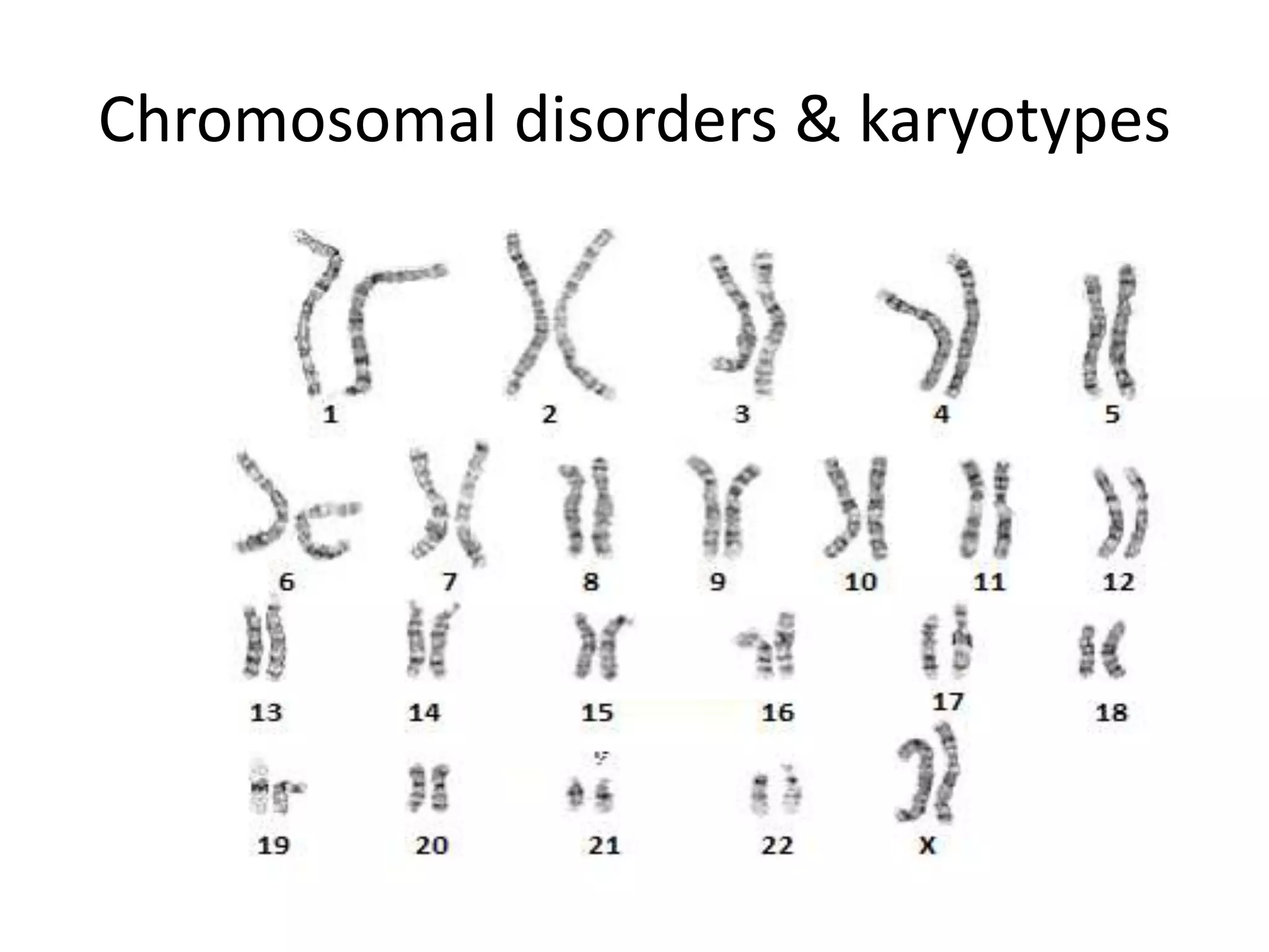 Karyotypes and dysmorphic features | PPTX