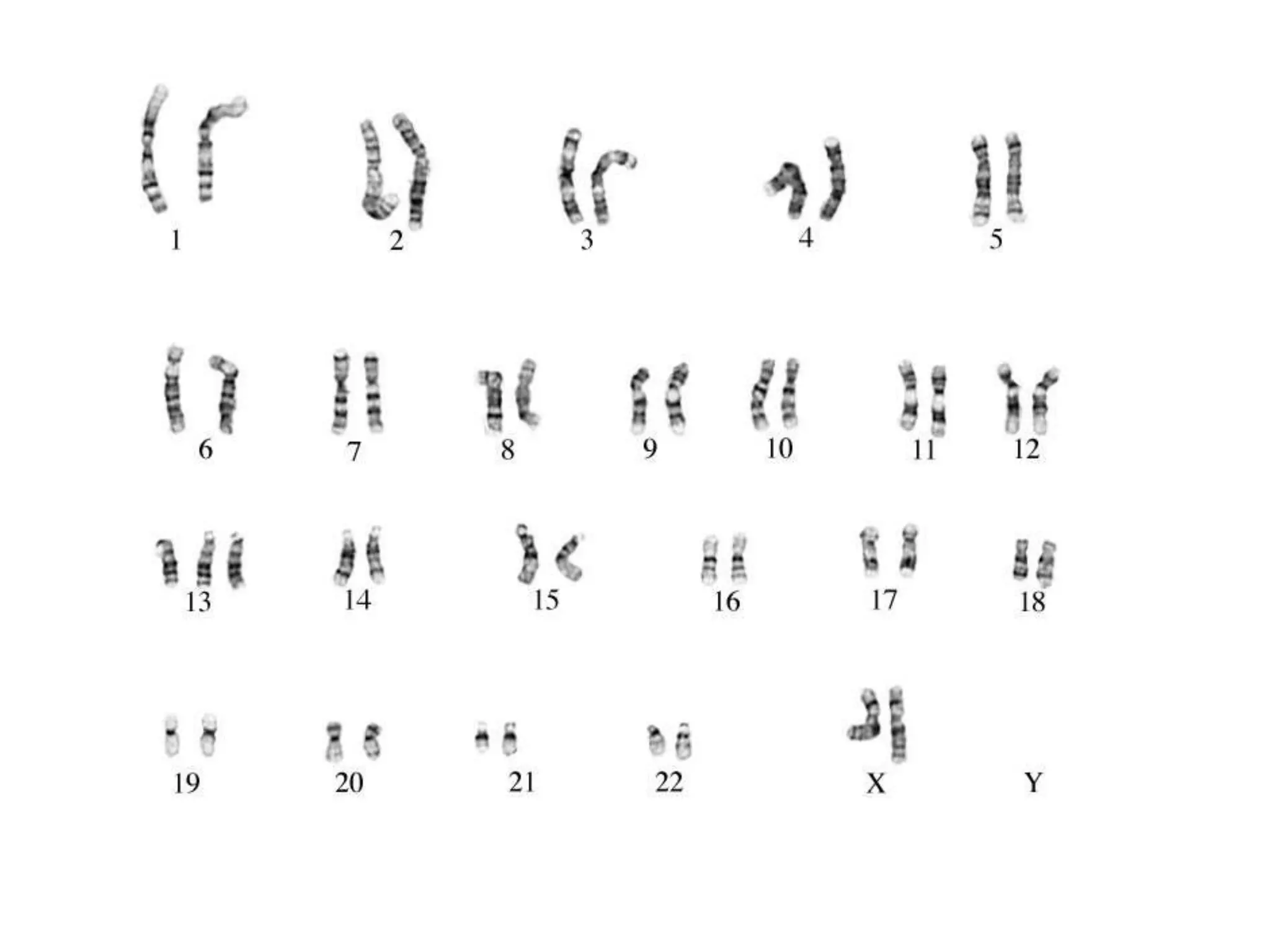 Karyotypes and dysmorphic features | PPT