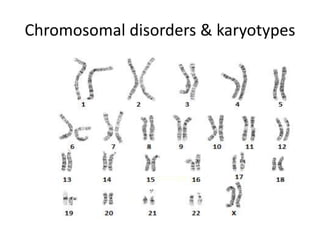 Karyotypes and dysmorphic features | PPT