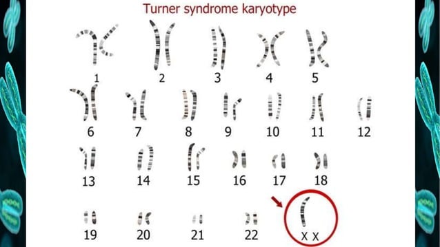 Karyotyping | PPTX