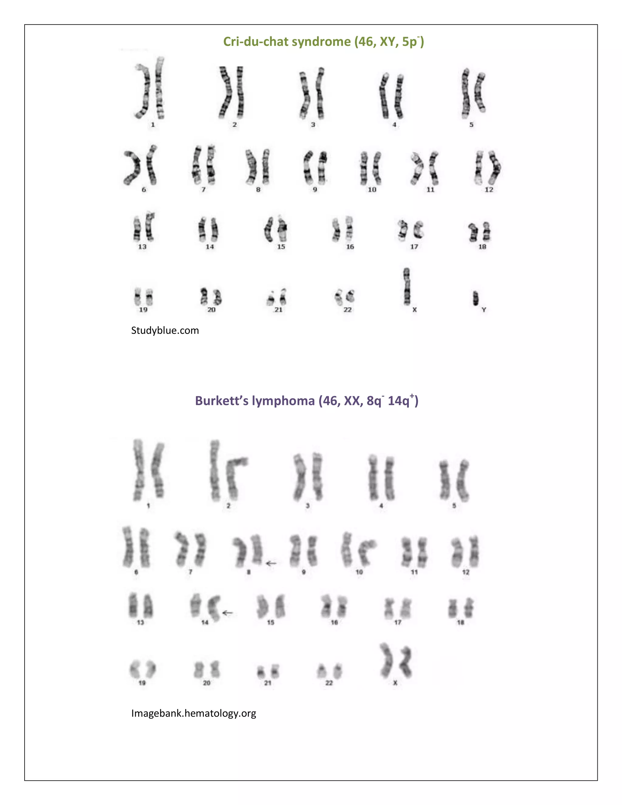 Karyotype in humans with genetic disorders | PDF | Genetics | Science