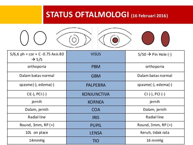 Kaspan katarak senilis imatur