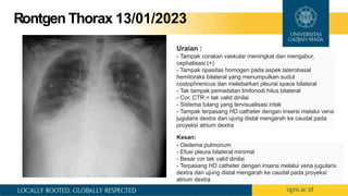Kasus CKD stage V.pptx
