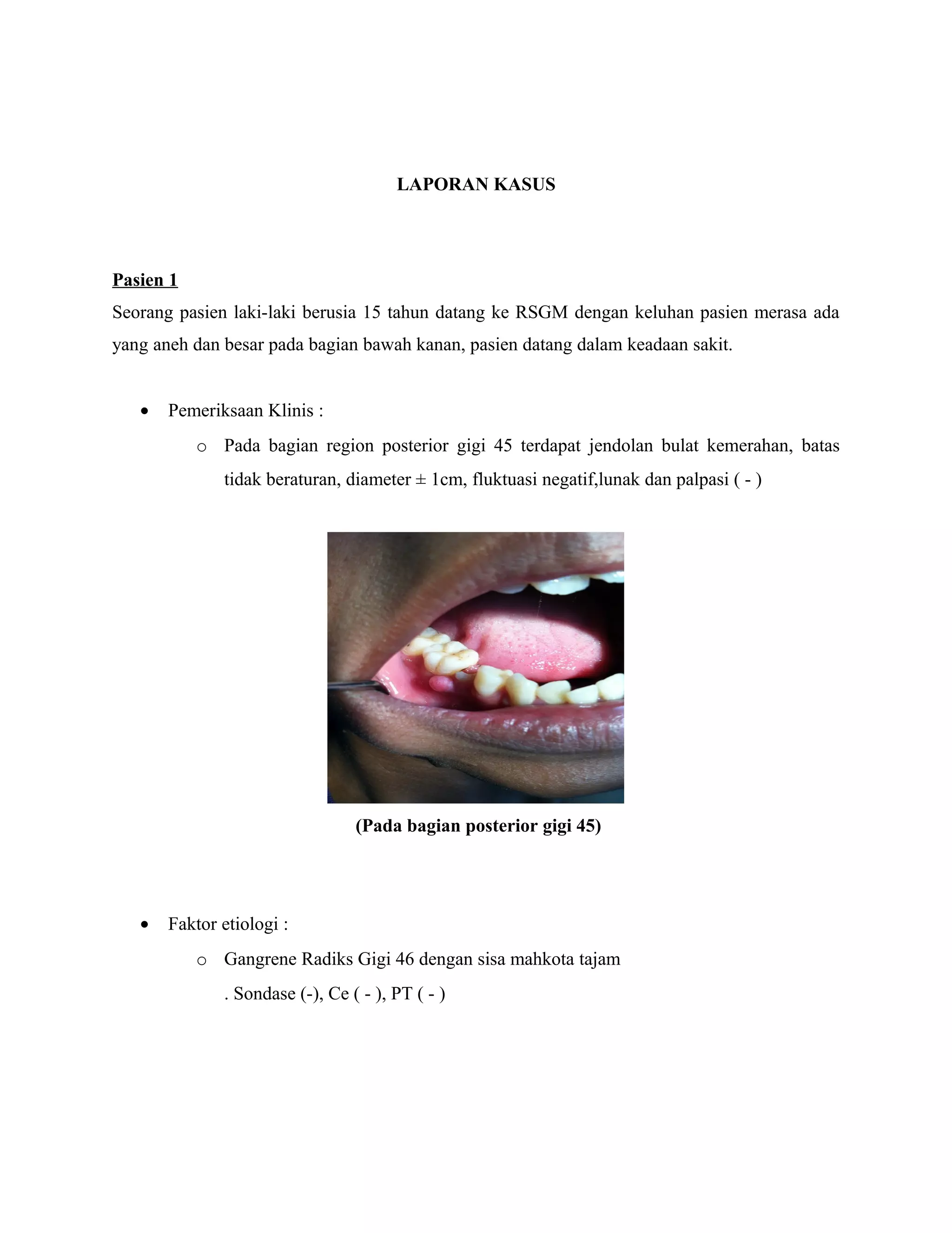 Epulis Fibromatosa ,Clinical Case (Oral surgery) | DOC