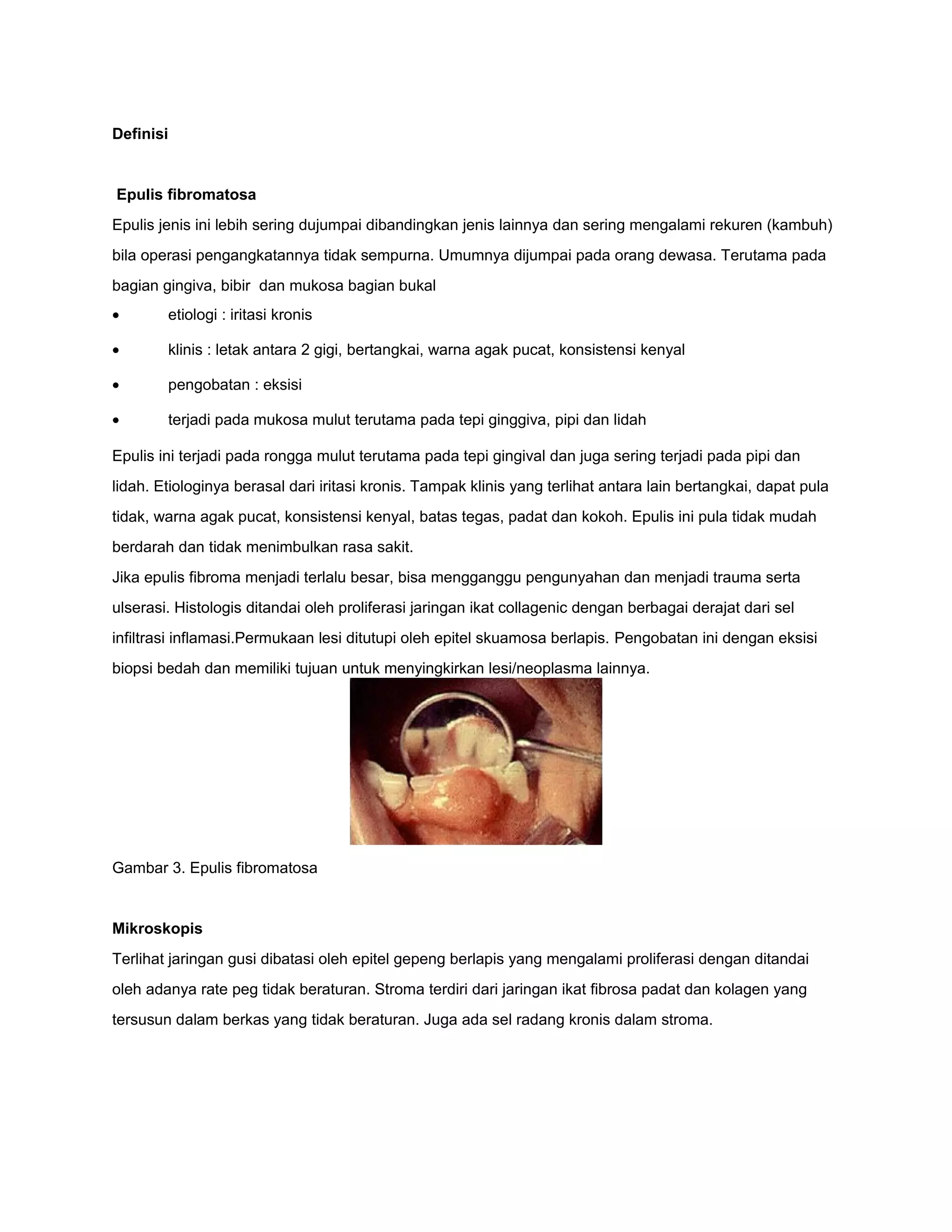Epulis Fibromatosa ,Clinical Case (Oral surgery) | DOC