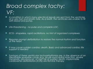Cardiac Arrhythmias | PPT