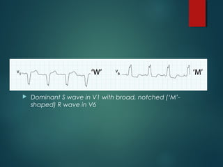 Cardiac Arrhythmias | PPT