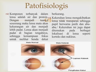 KATARAK SENILIS.pptx ABOUT HEALTHCARE PPT | PPTX