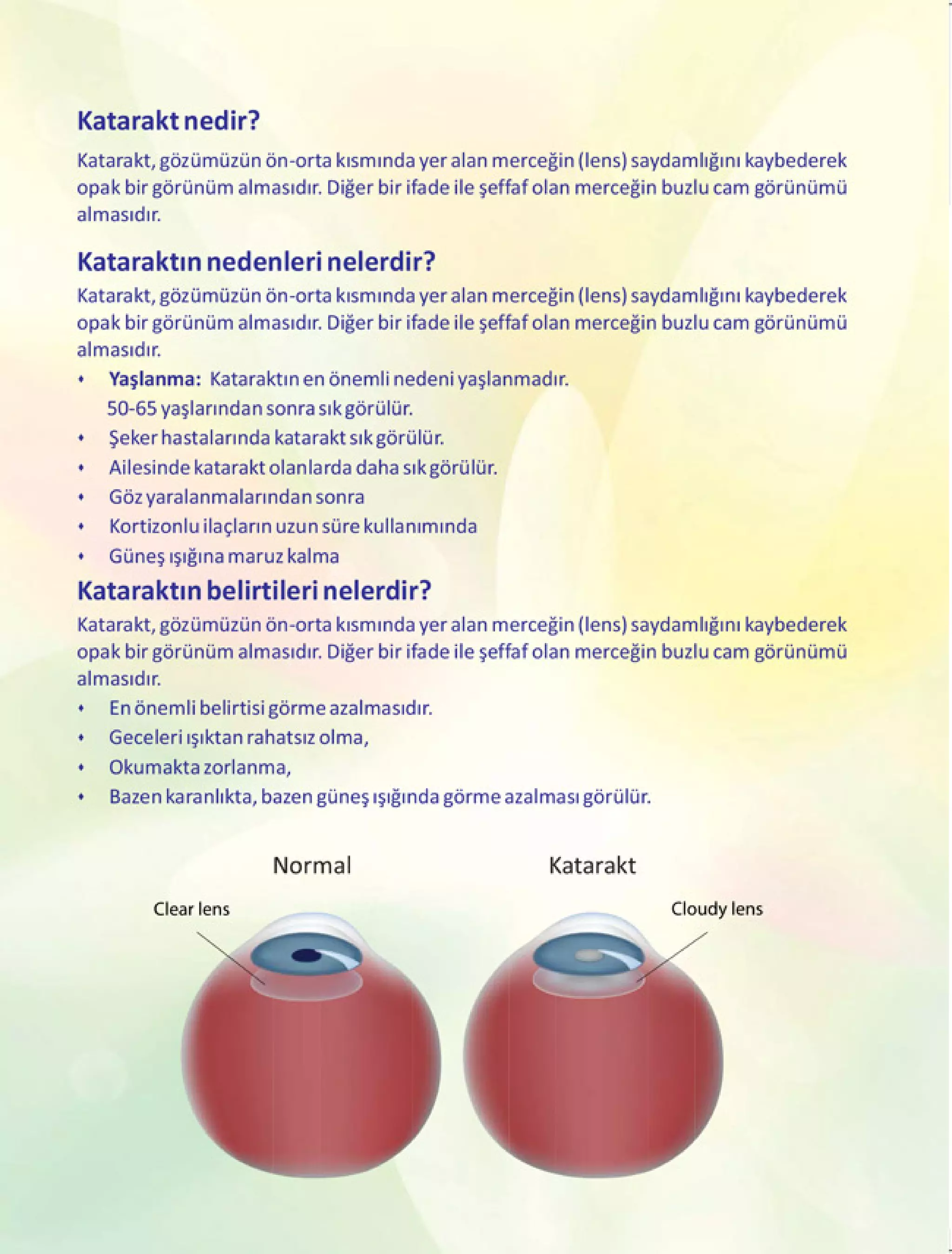 Katarakt Nedir? | PDF