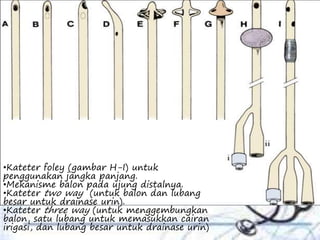 teknik pemasangan Kateter | PPT